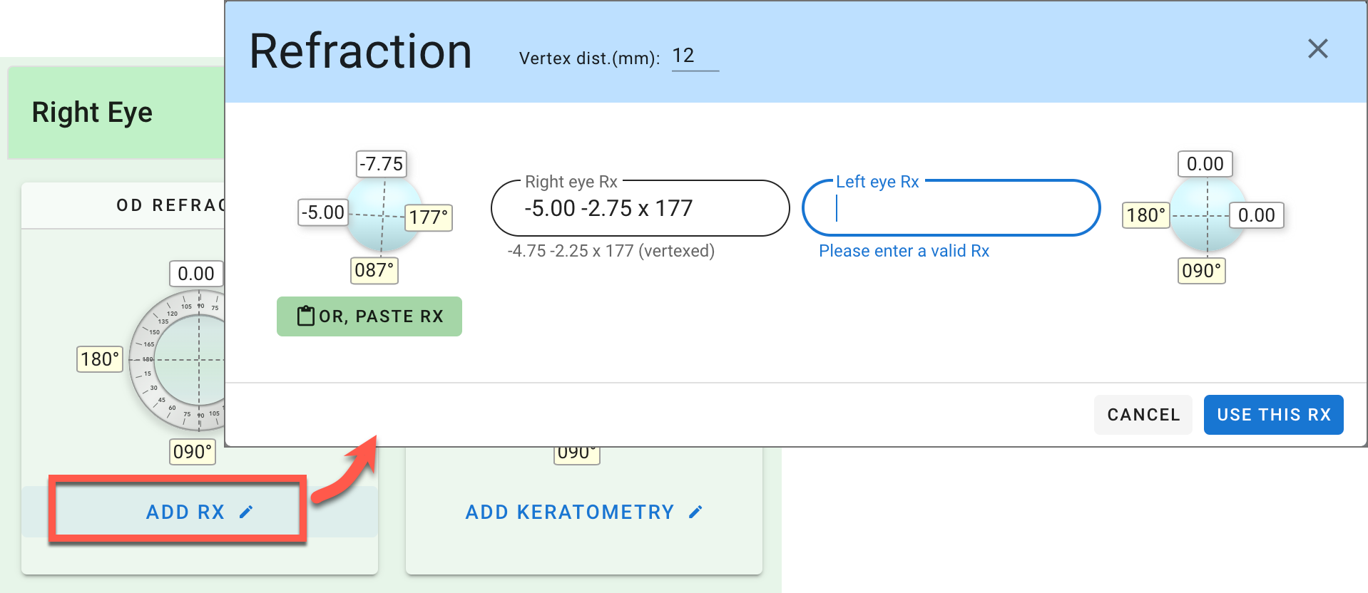 Icd 10 Coding For Refraction Part 1 Of 3 Youtube