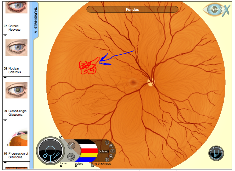 EyeDock - Contact Lens Clinical Reference
